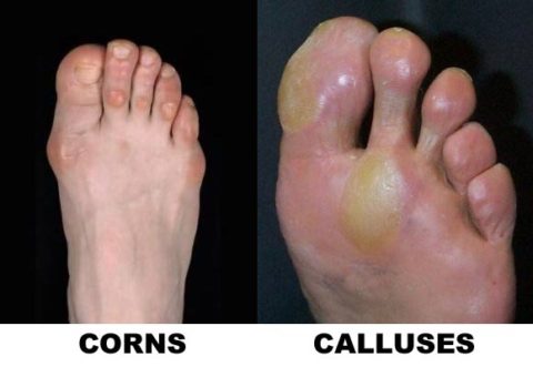 Glossary | Foot Law